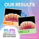 Dental Wireless 4-in-1 Water Flosser - Optimal Oral Hygiene at Your ...