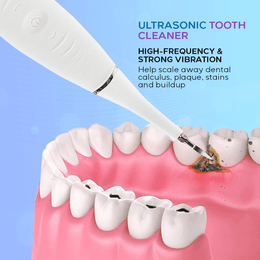 Ultrasonic Tooth Cleaner - Dental Hygiene Tool for Plaque Removal ...